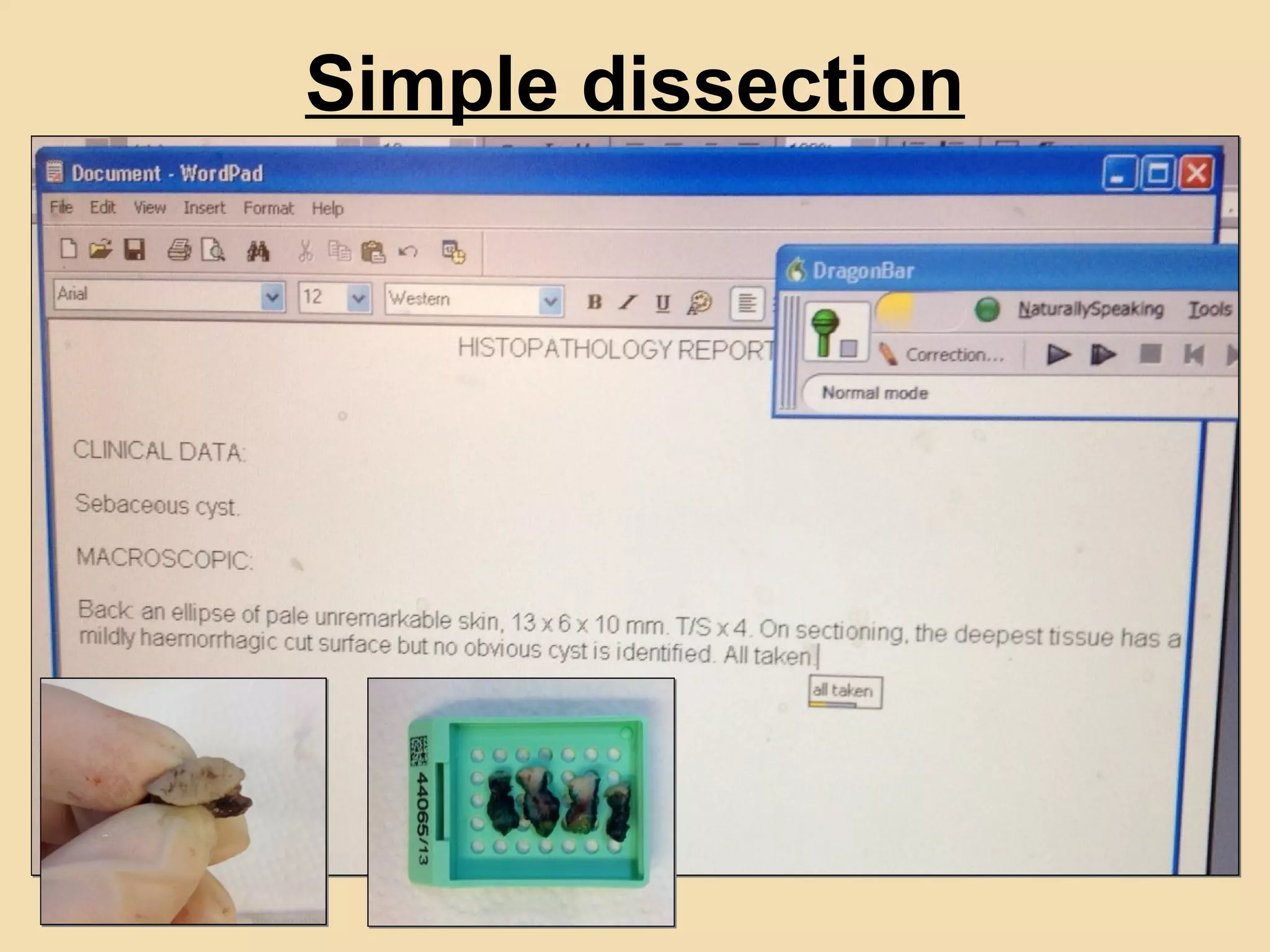 Histopathology In Practice - Sample Reception, Dissection, Processing, Embedding. | PPT