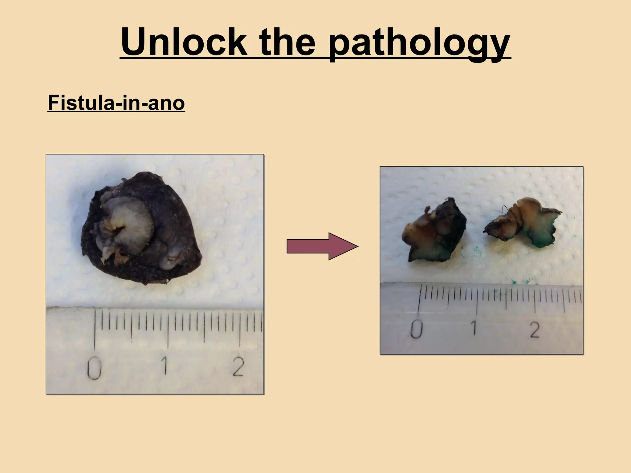 Histopathology In Practice - Sample Reception, Dissection, Processing, Embedding. | PPT