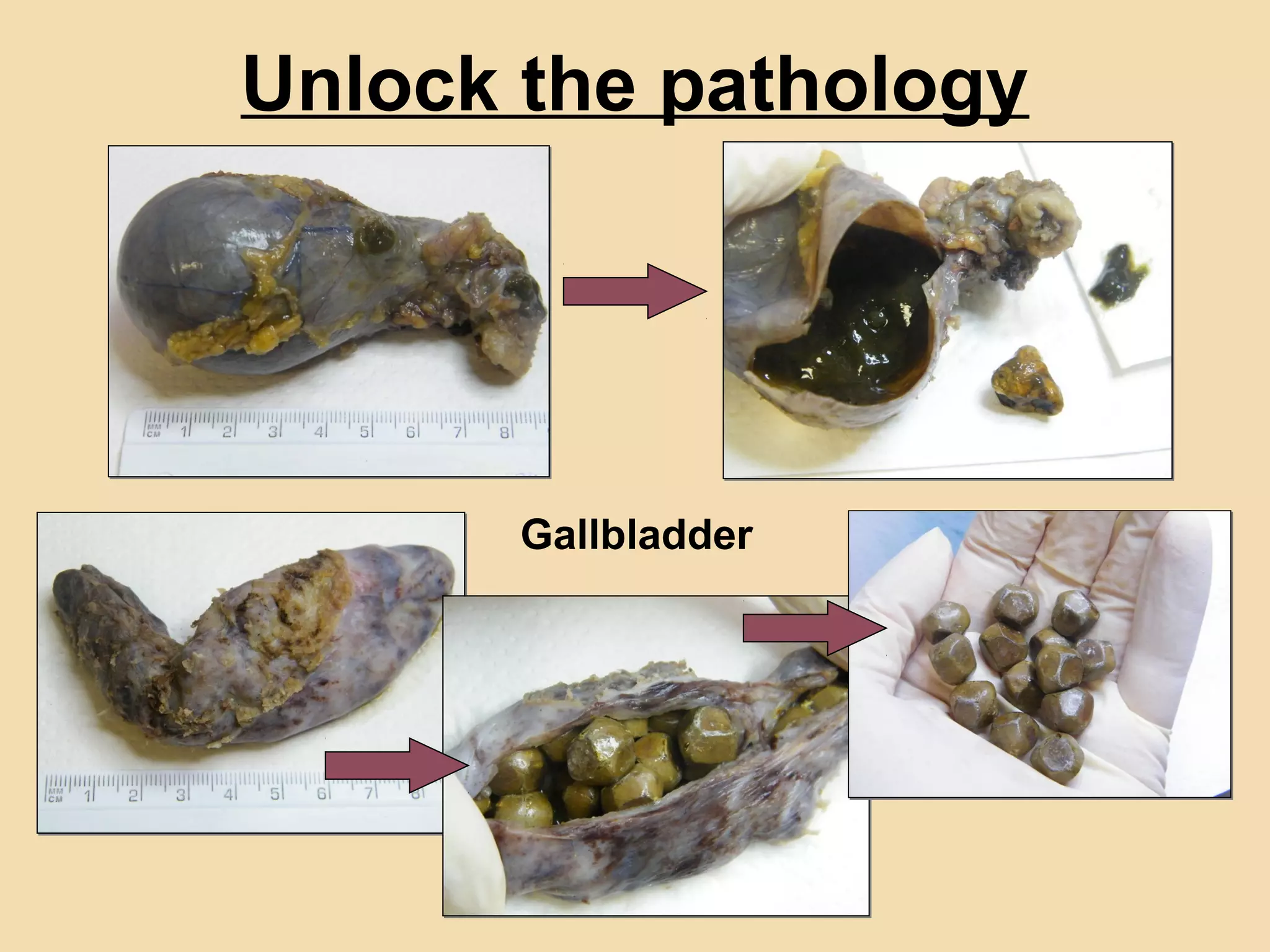 Histopathology In Practice - Sample Reception, Dissection, Processing, Embedding. | PPT
