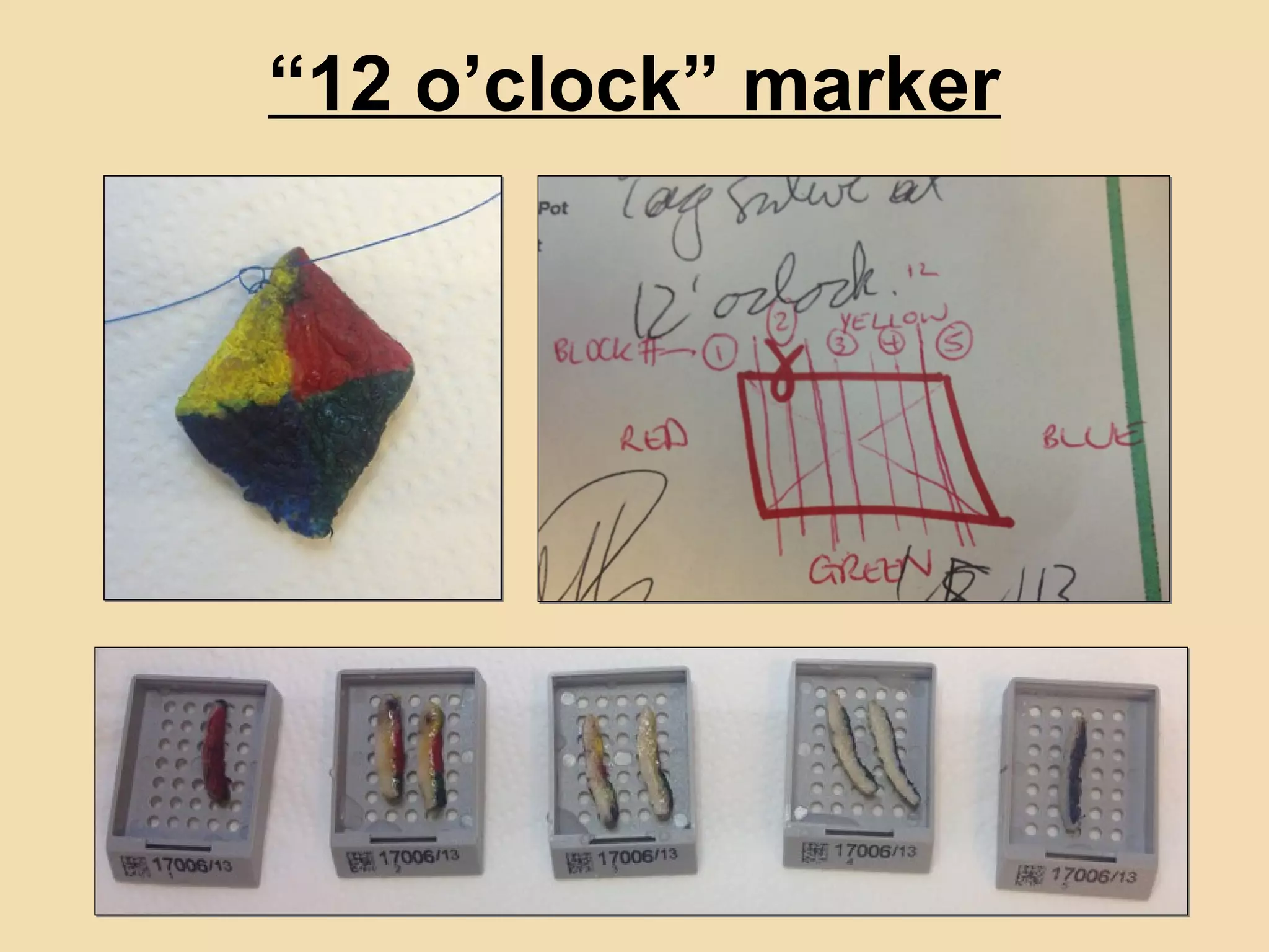Histopathology In Practice - Sample Reception, Dissection, Processing ...