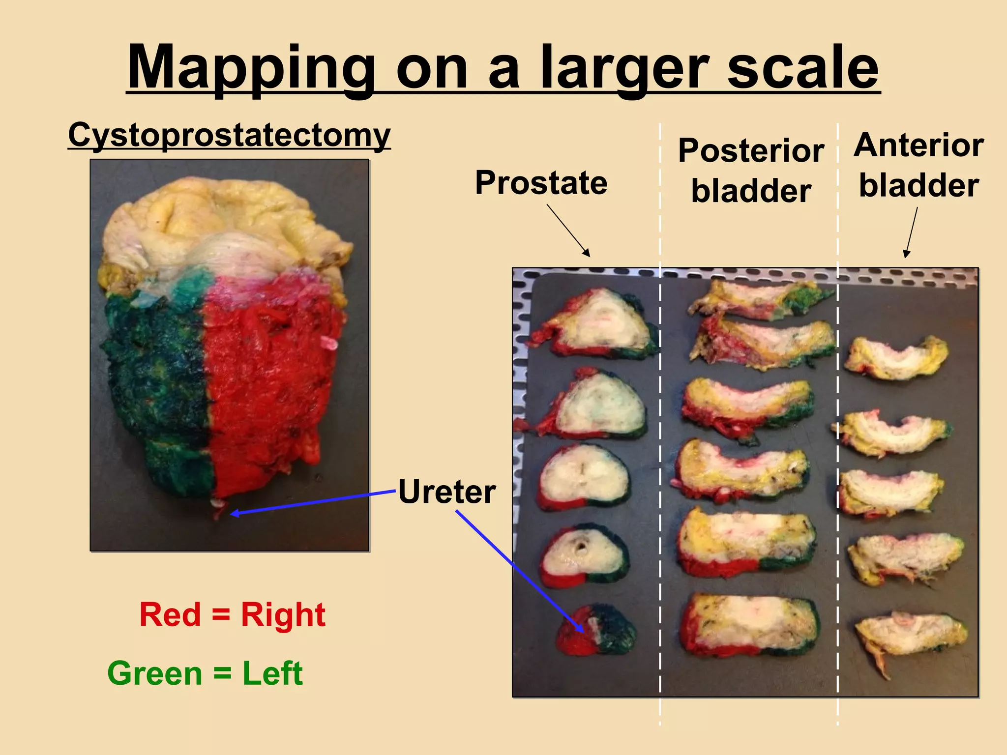 Histopathology In Practice - Sample Reception, Dissection, Processing, Embedding. | PPT