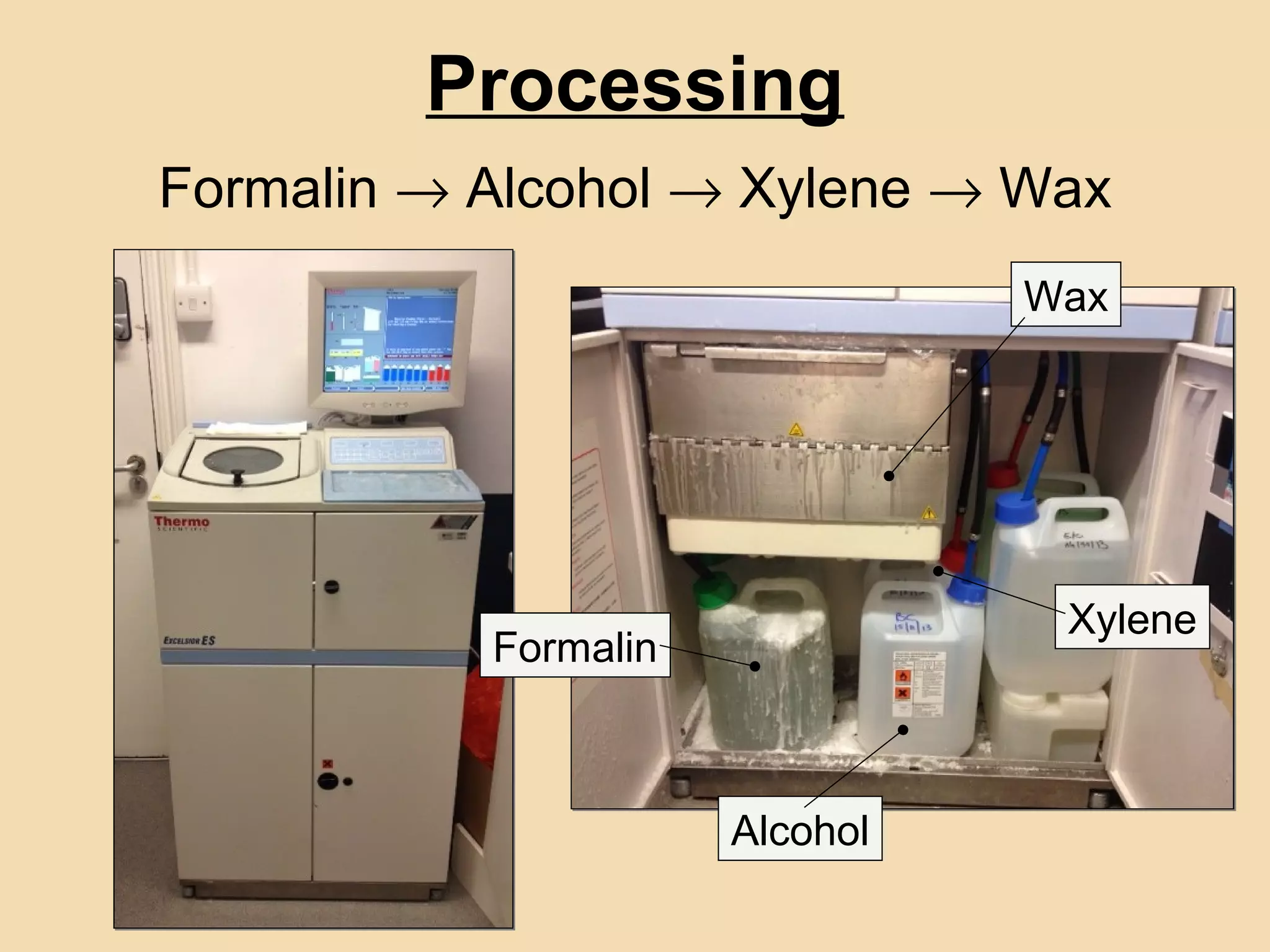 Histopathology In Practice - Sample Reception, Dissection, Processing, Embedding. | PPT
