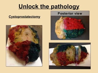 Histopathology In Practice - Sample Reception, Dissection, Processing, Embedding. | PPT