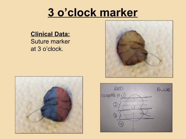 Histopathology In Practice - Sample Reception, Dissection, Processing ...