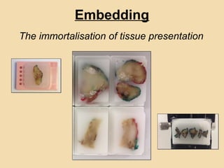 Histopathology In Practice - Sample Reception, Dissection, Processing, Embedding. | PPT