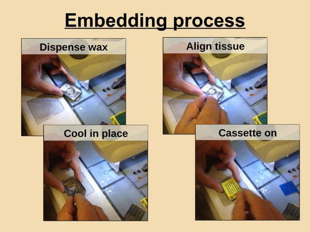 Histopathology In Practice - Sample Reception, Dissection, Processing, Embedding. | PPT