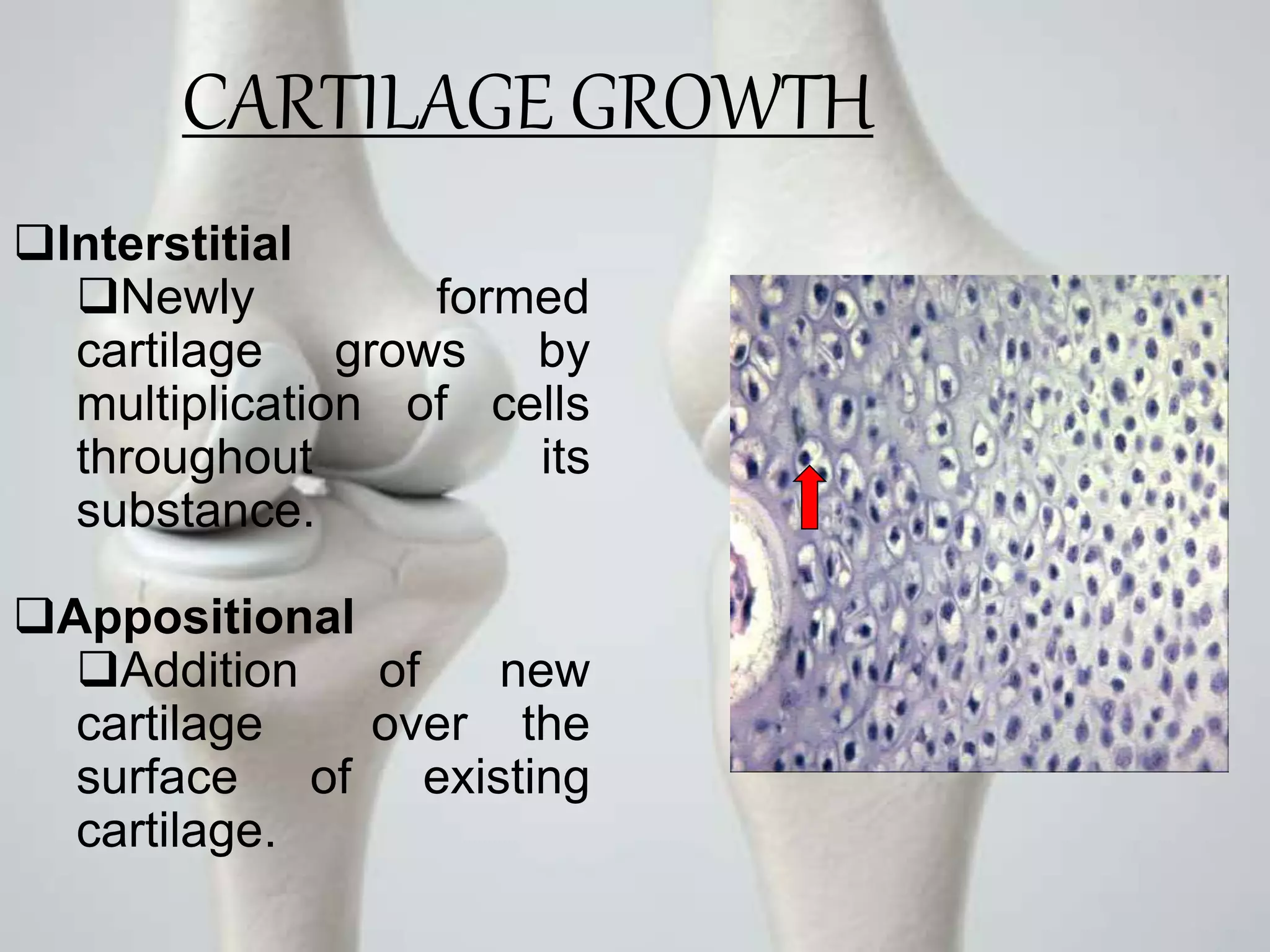 CARTILIAGE AGE AND HISTOLOGY REGENERATION OF BONE {HEMANT RAO} | PPT
