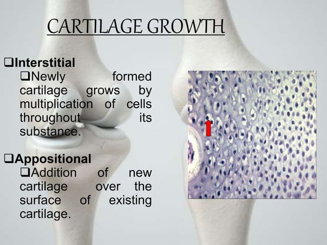 CARTILIAGE AGE AND HISTOLOGY REGENERATION OF BONE {HEMANT RAO} | PPT