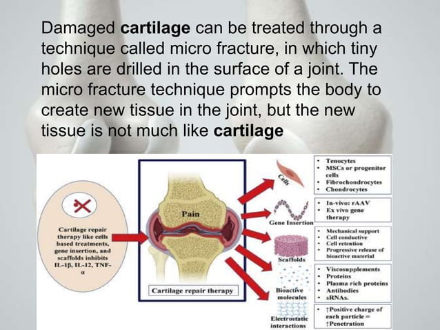 CARTILIAGE AGE AND HISTOLOGY REGENERATION OF BONE {HEMANT RAO} | PPT