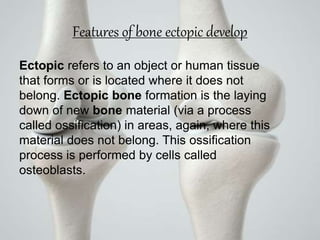 CARTILIAGE AGE AND HISTOLOGY REGENERATION OF BONE {HEMANT RAO} | PPTX ...