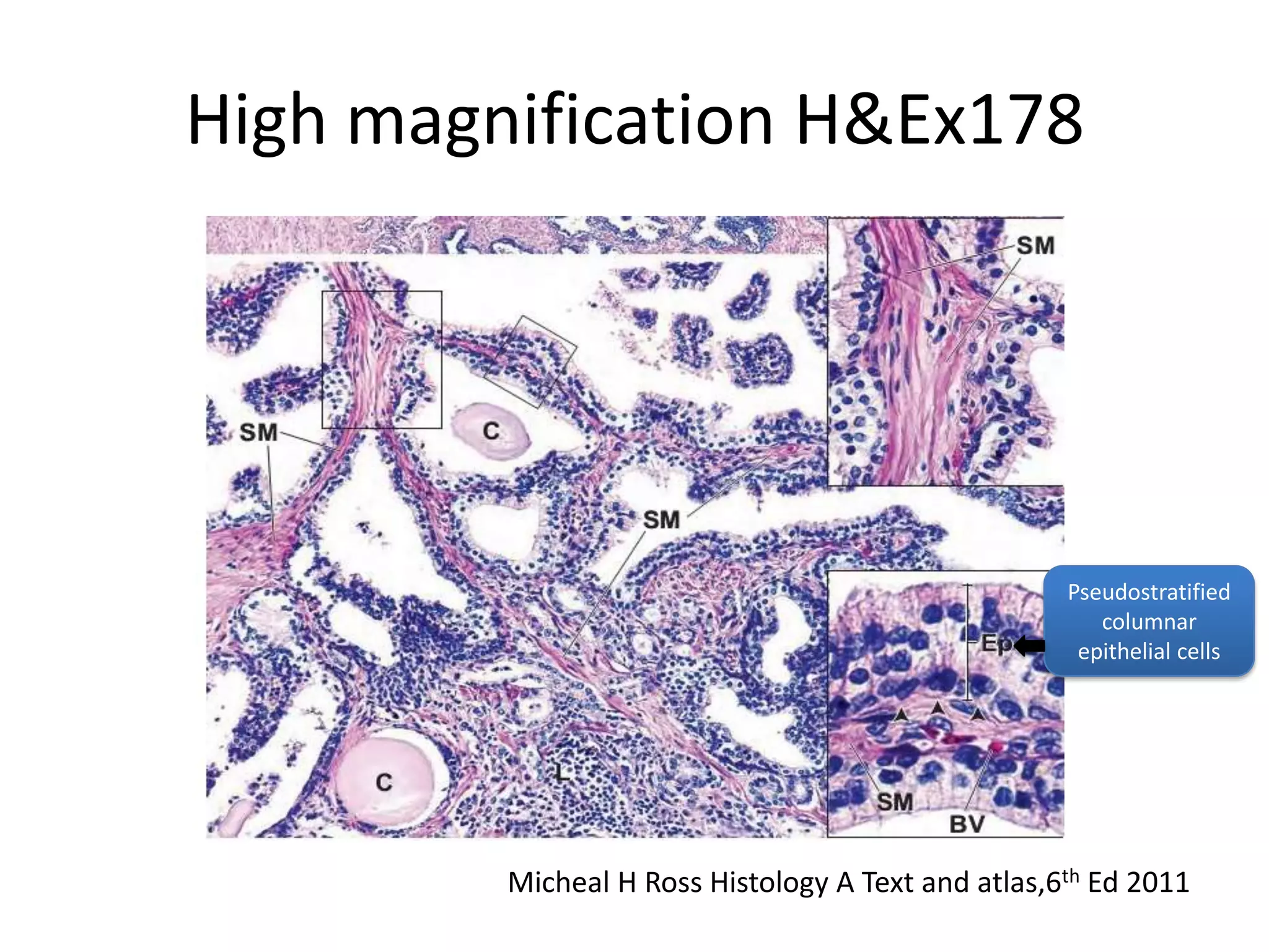 Histology Of Accessory Sex Glands Of Male Pptx