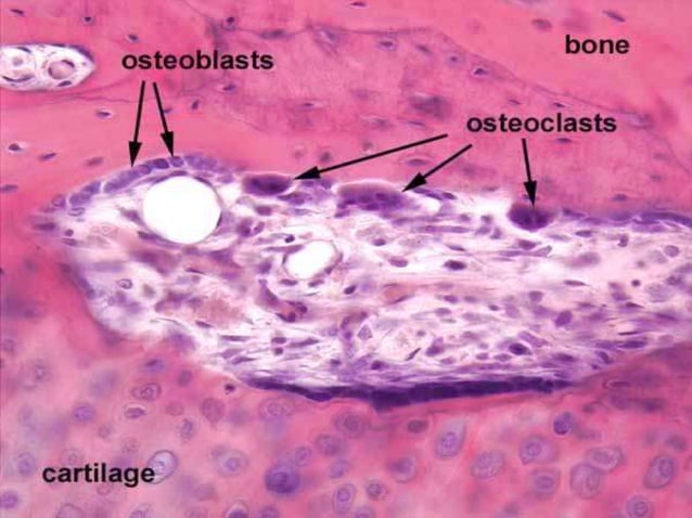 Histology of bone
