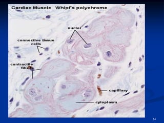Cardiac Muscle Tissue Slides
