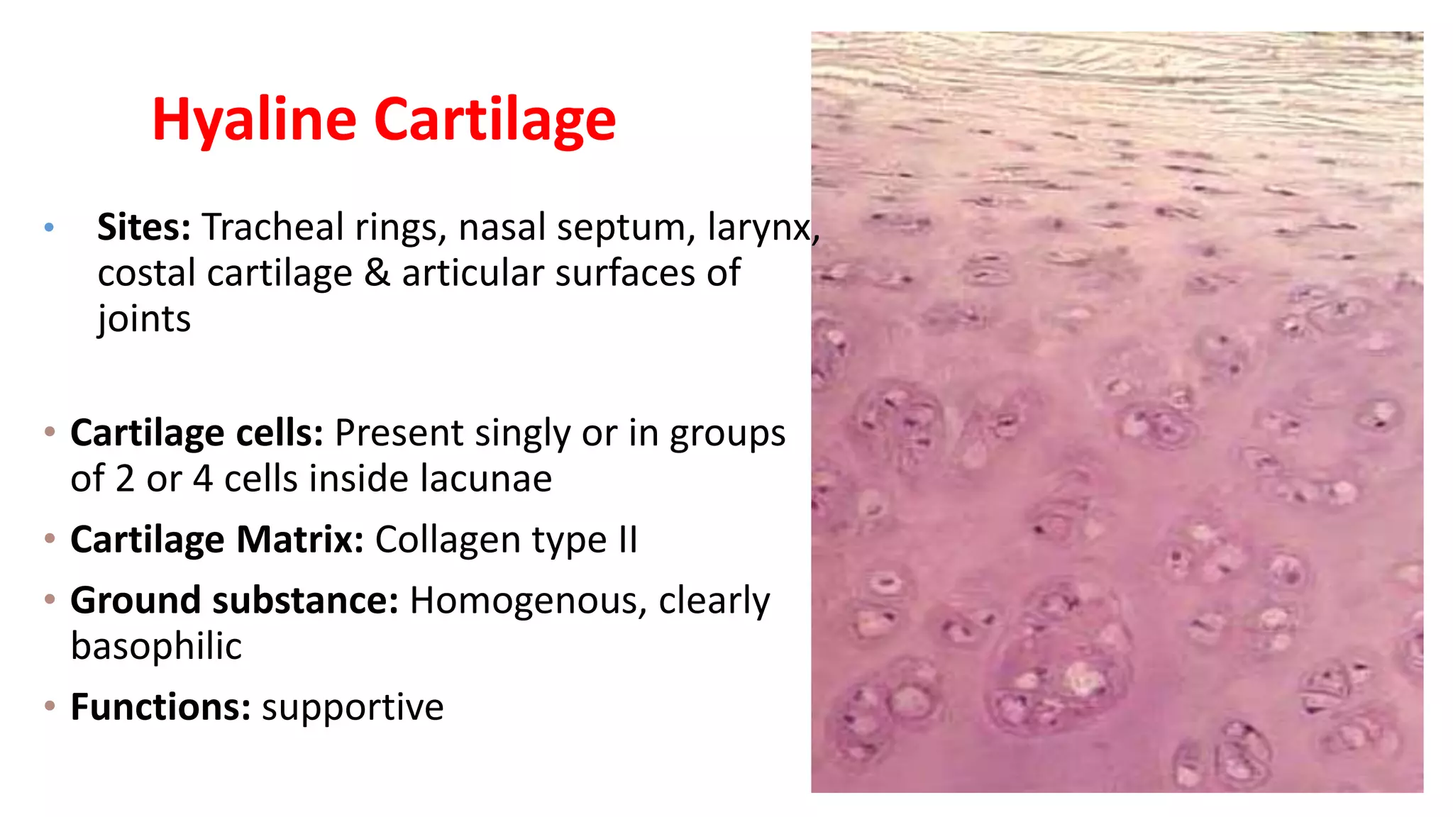 Histology of Cartilage.pptx | Bone and Joint Conditions | Diseases and ...