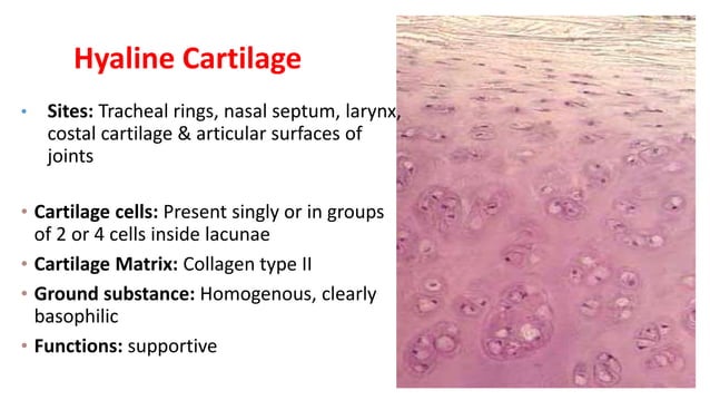 Histology of Cartilage.pptx | Bone and Joint Conditions | Diseases and Conditions