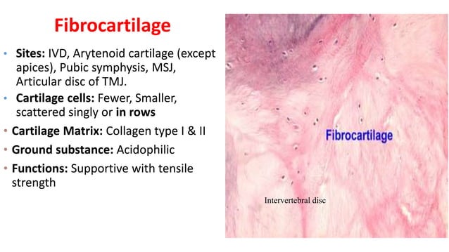 Histology of Cartilage.pptx | Bone and Joint Conditions | Diseases and ...