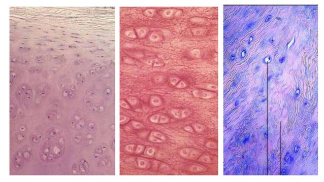 Histology of Cartilage.pptx | Bone and Joint Conditions | Diseases and ...