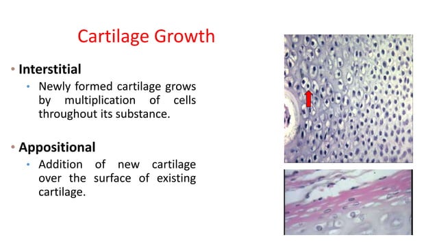 Histology of Cartilage.pptx | Bone and Joint Conditions | Diseases and Conditions