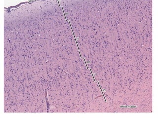 Histology of cerebellum and cerebrum