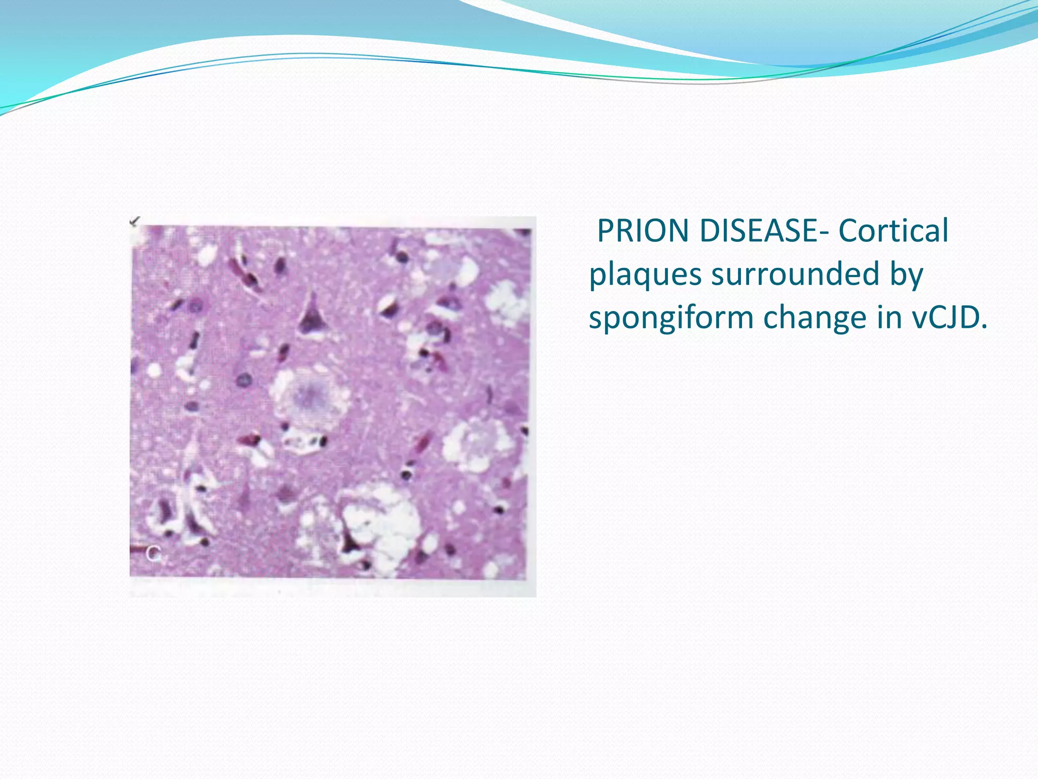 Histology of cerebral cortex | PPTX