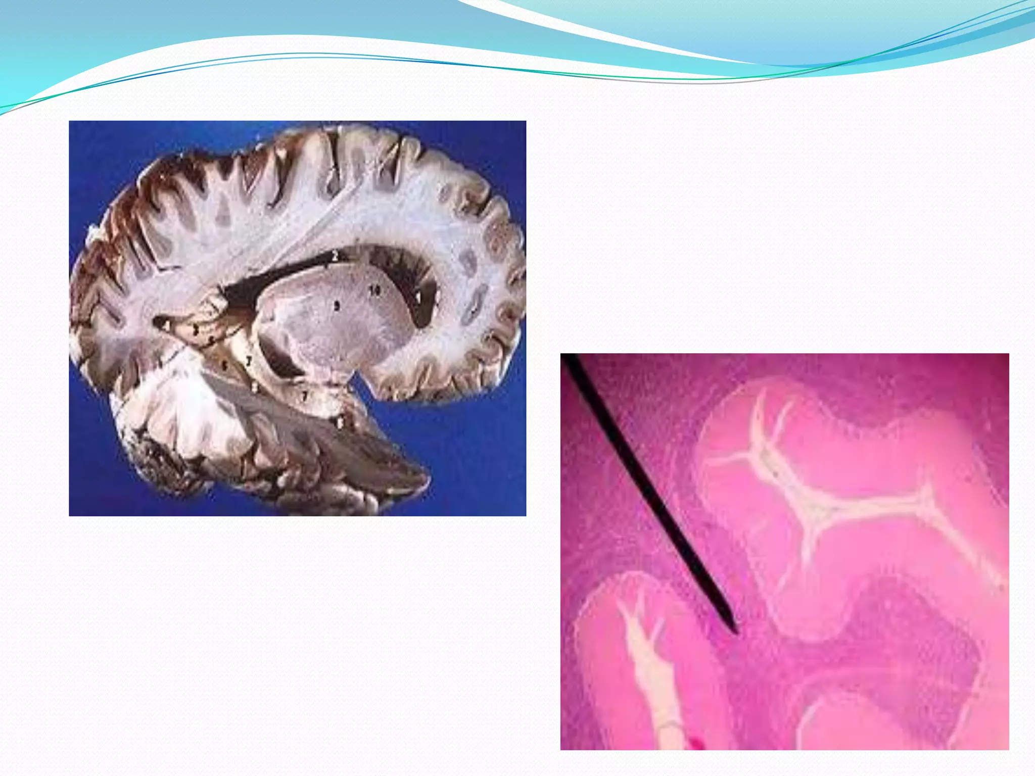 Histology of cerebral cortex | PPTX
