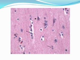 Histology of cerebral cortex | PPTX