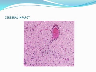 Histology of cerebral cortex | PPTX