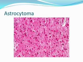 Cerebral Cortex Histology Layers