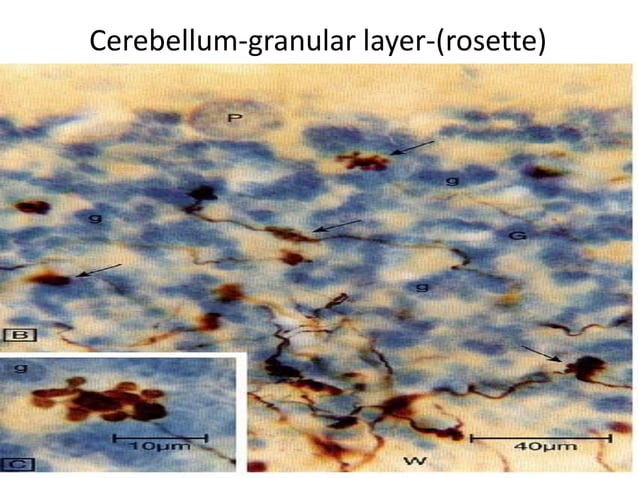 Histology of cerebrum and cerebellum | PDF