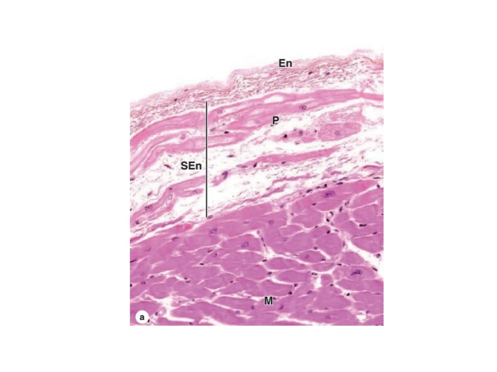 Histology of Circulatory System,arteries veins capillaries small medium ...