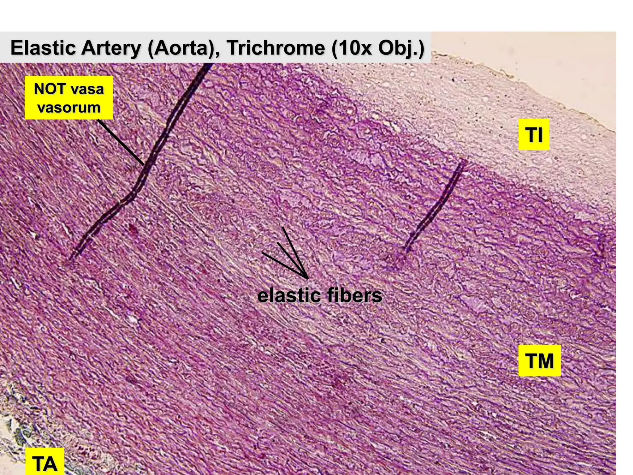 Histology of Circulatory System,arteries veins capillaries small medium ...