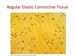 Elastic Connective Tissue Labeled