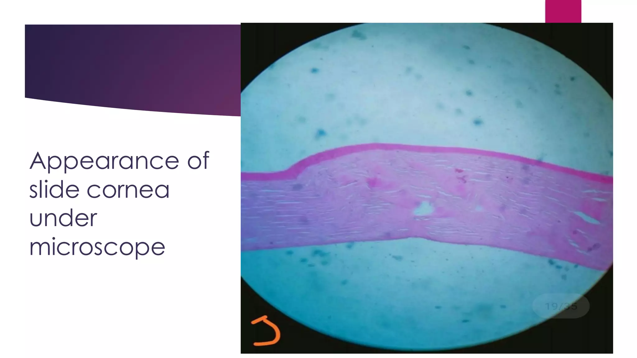 Histology of cornea and retina (1) | PDF