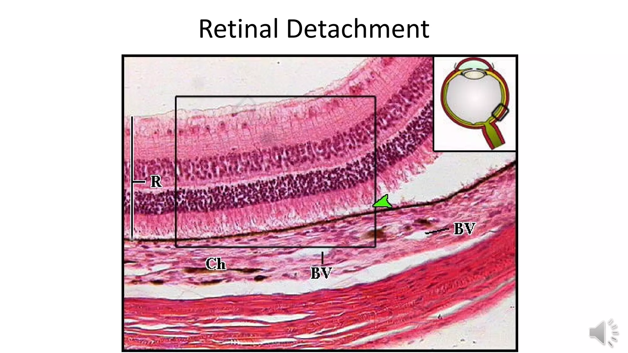 Histology of Cornea & Retina | PDF