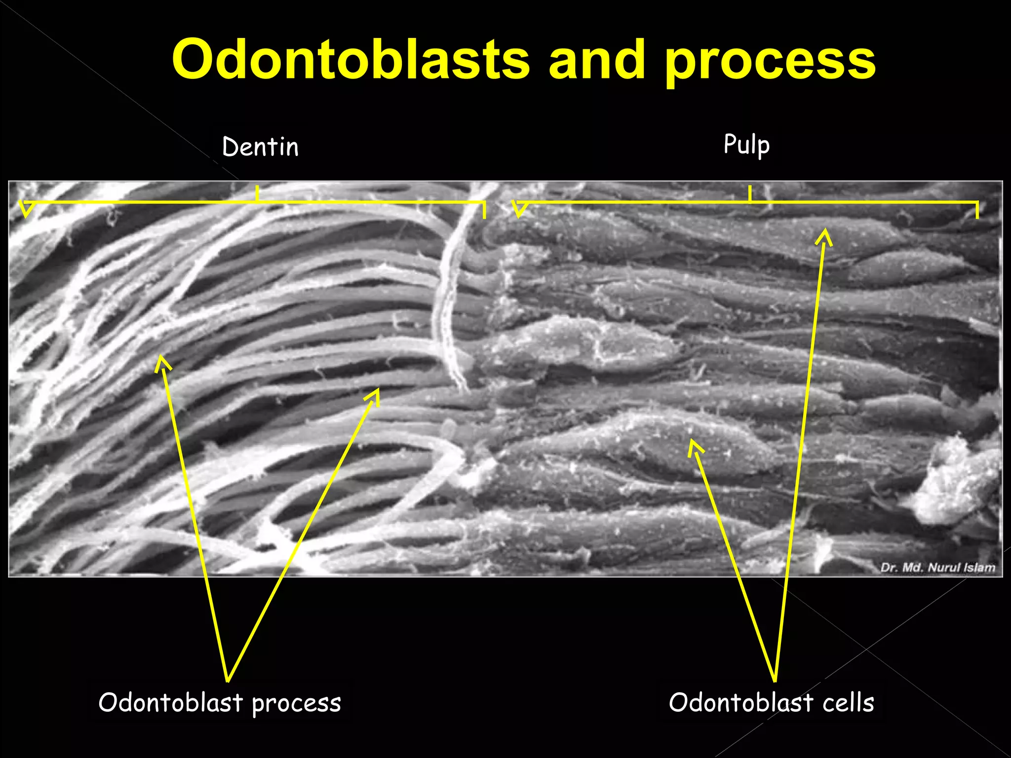 Histology of dentin | PPT