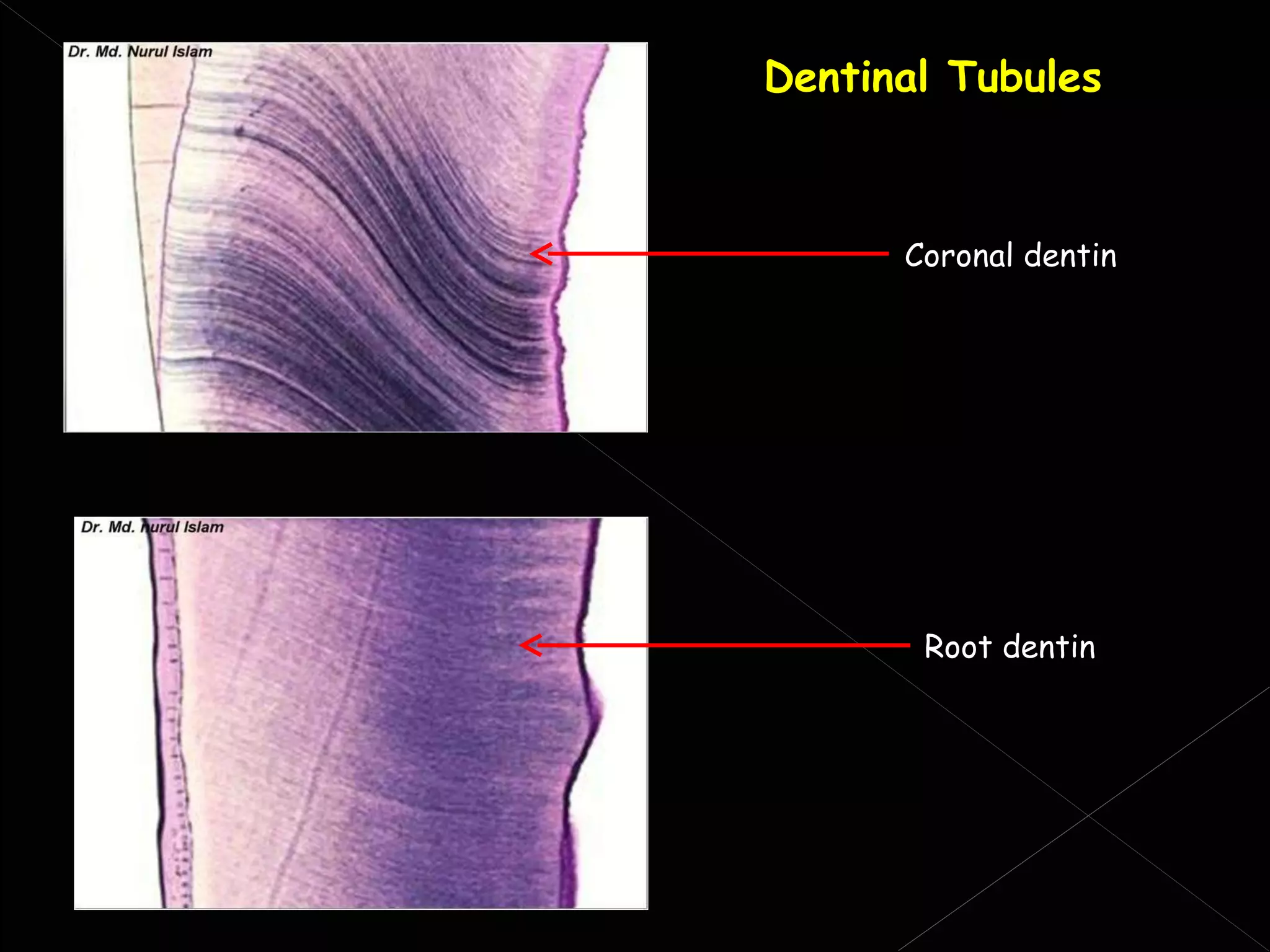 Histology of dentin | PPT