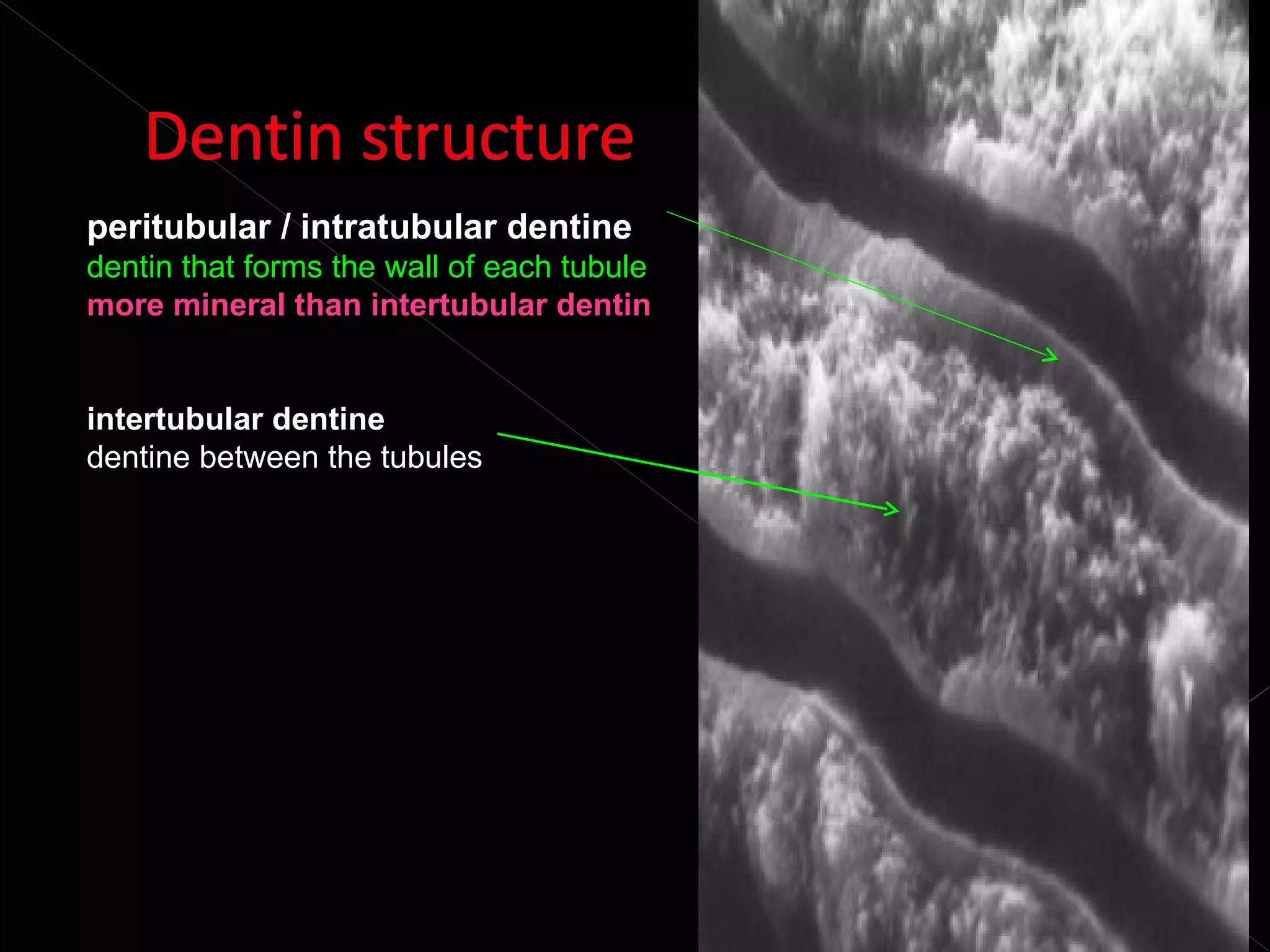 Histology of dentin | PPT