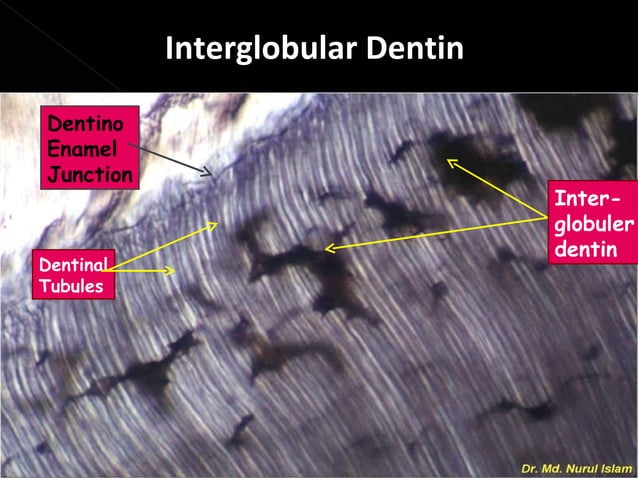 Histology of dentin | PPT | Dental Health | Diseases and Conditions