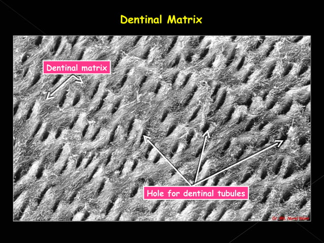Histology of dentin | PPT | Dental Health | Diseases and Conditions