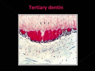 Histology of dentin | PPT