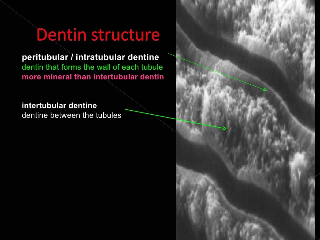 Histology of dentin