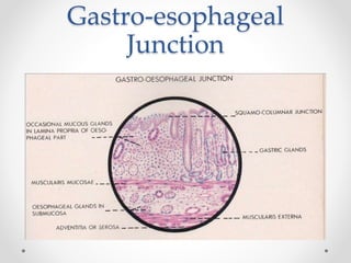 Gastroesophageal Junction Histology Labeled