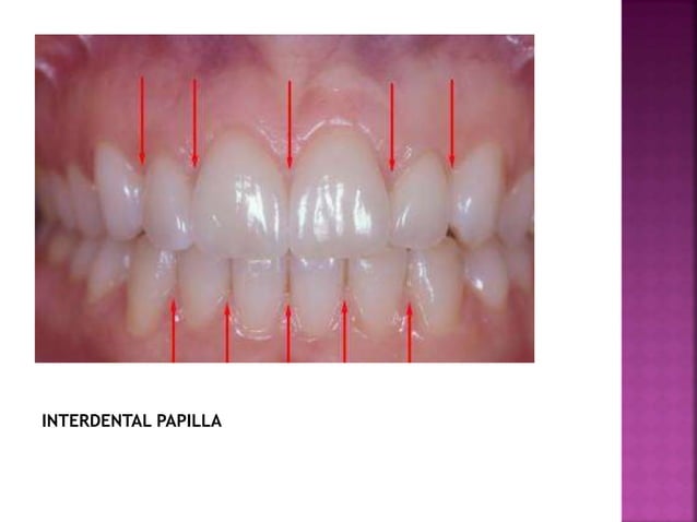 Histology of Gingiva | PPTX | Dental Health | Diseases and Conditions