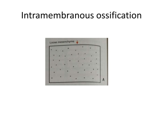 Histology of growth plate (2)n | PPT