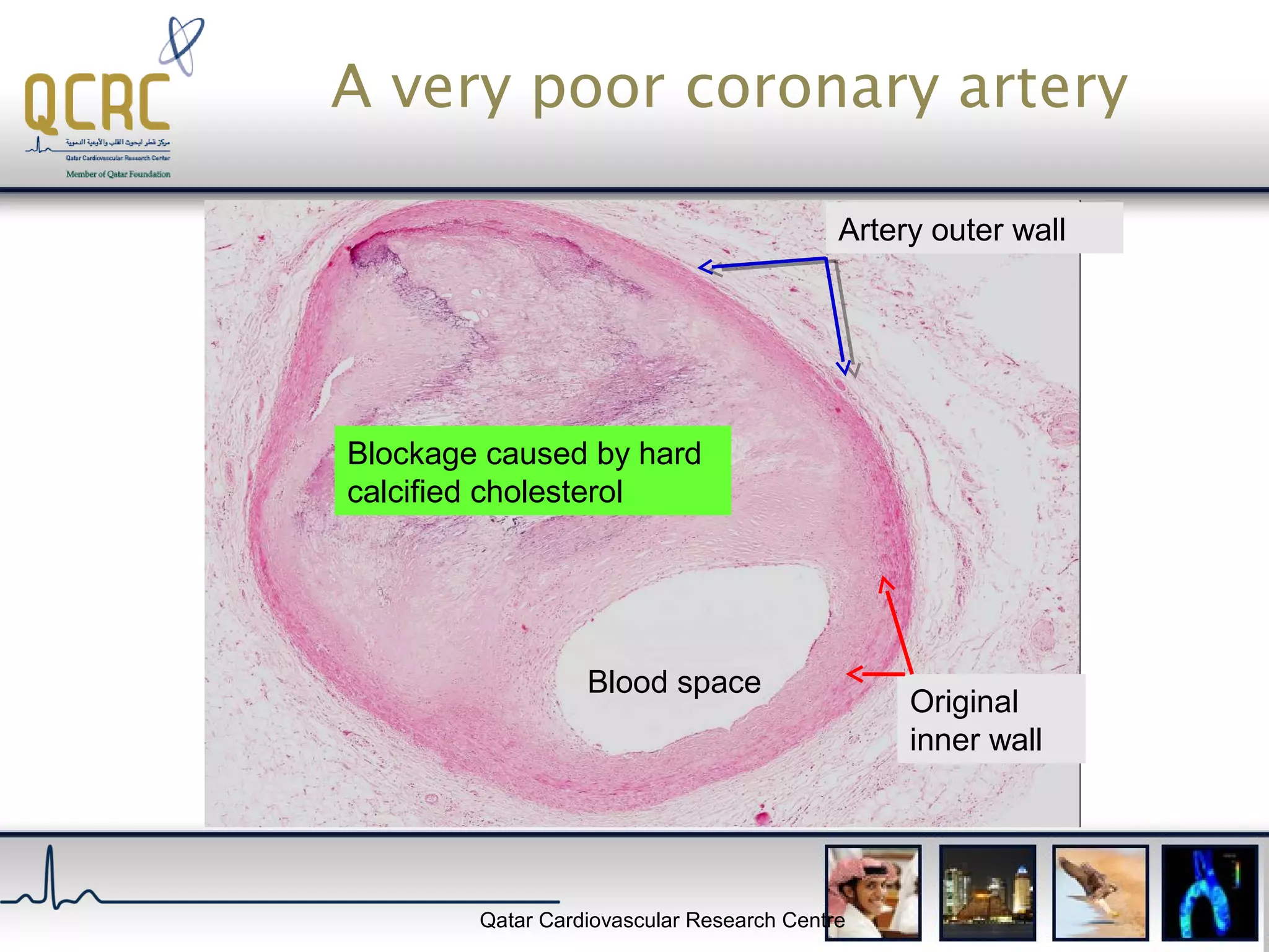 Histology of heart disease | PPT