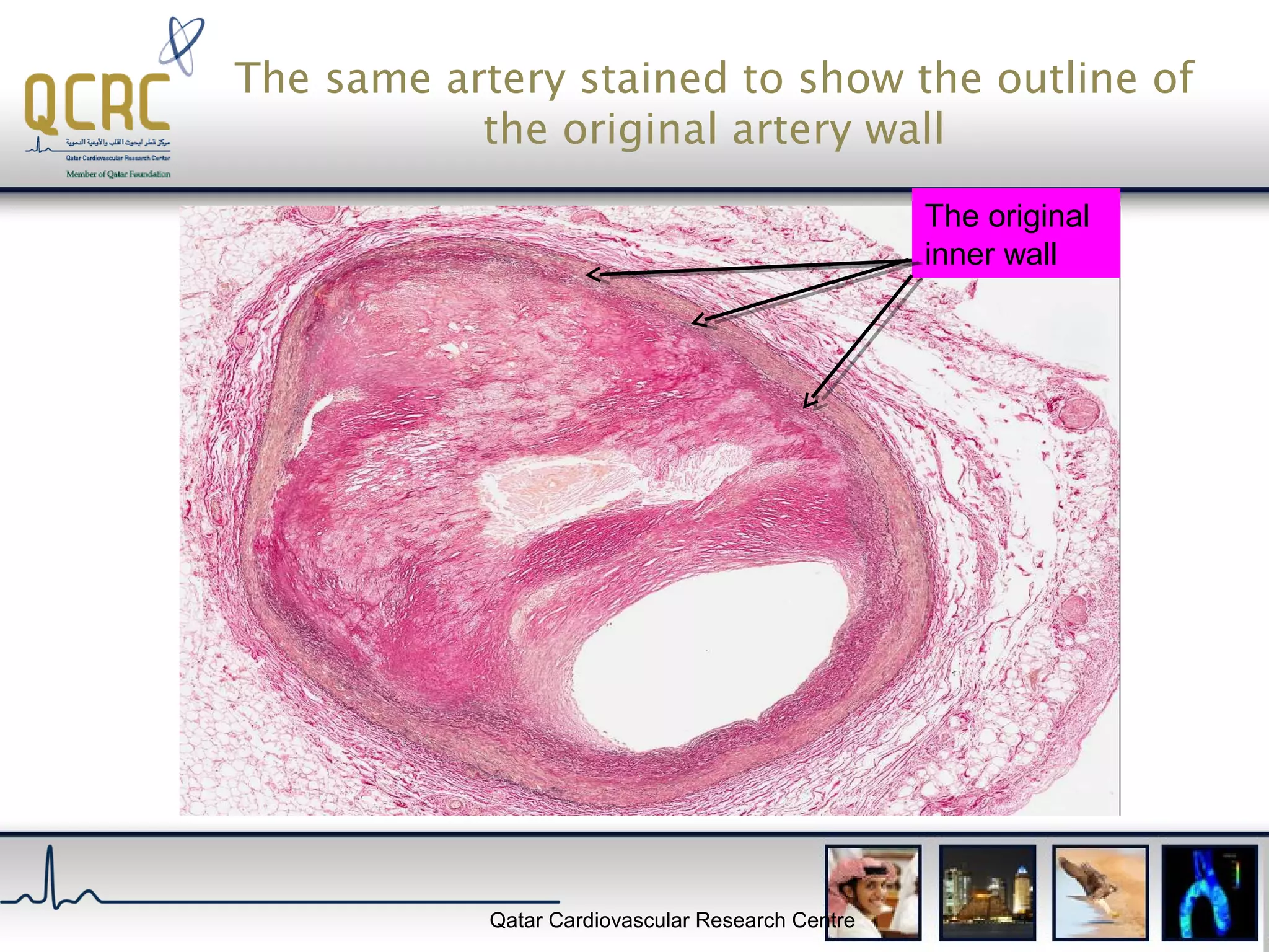 Histology of heart disease | PPT