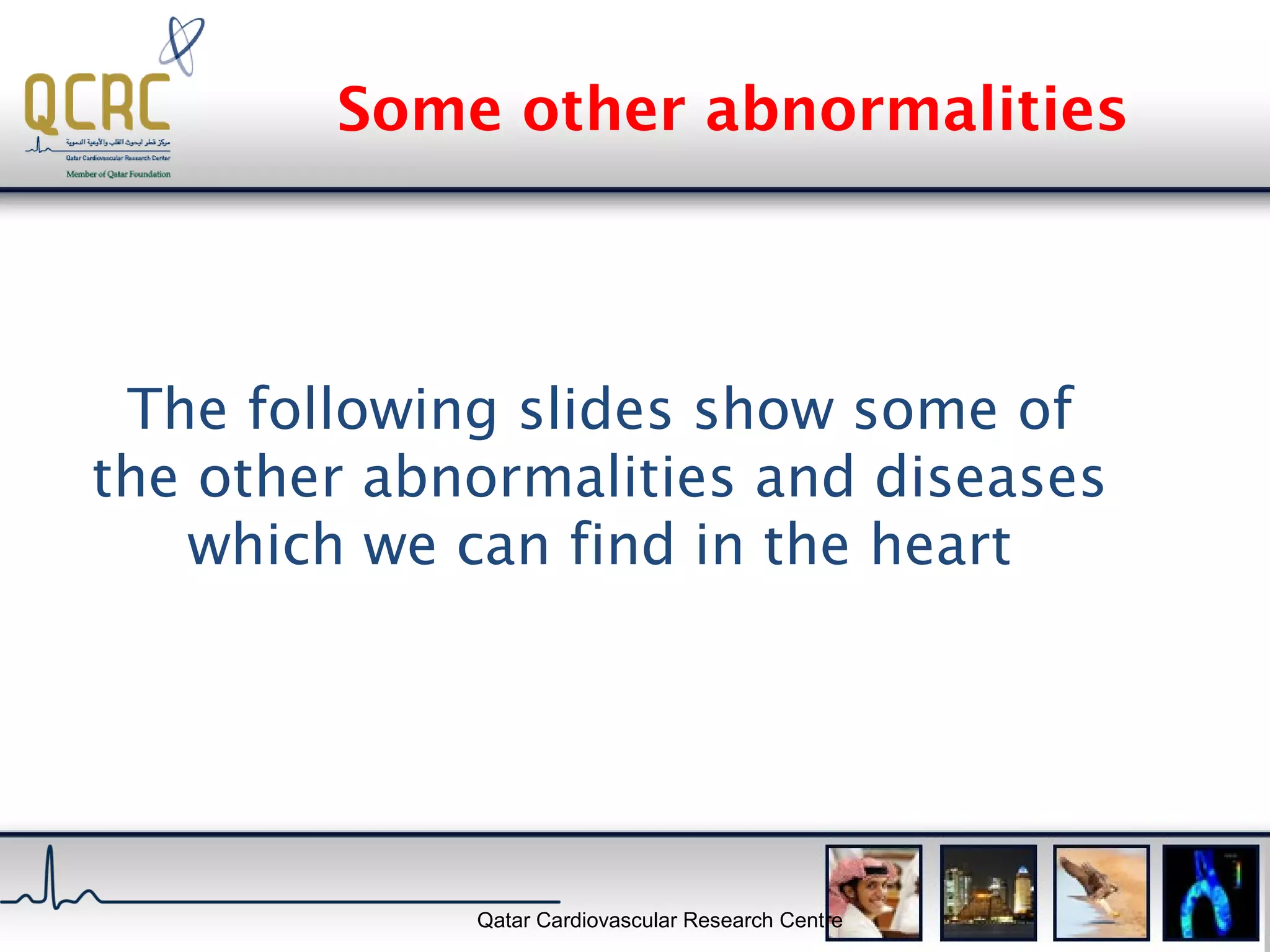 Histology of heart disease | PPT
