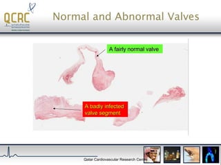 Histology of heart disease | PPT