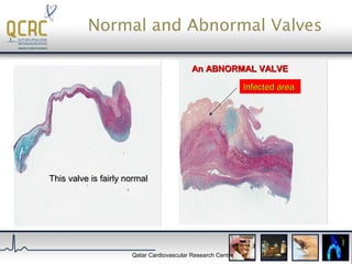 Histology of heart disease | PPT