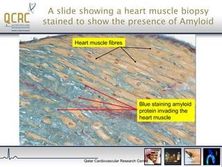 Histology of heart disease | PPT